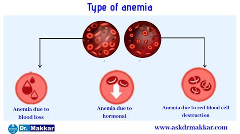 Anemia Homeopathic Treatment Dr Makkar India Punjab Mohali