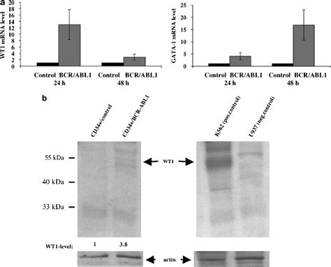 Forced Expression Of Bcrabl1 In Cd34 Progenitors Increases Expression