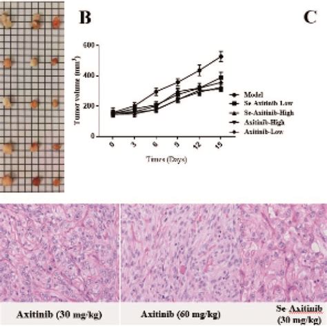Effect Of Axitinib And Se Axitinib On Liver And Renal Function Indices