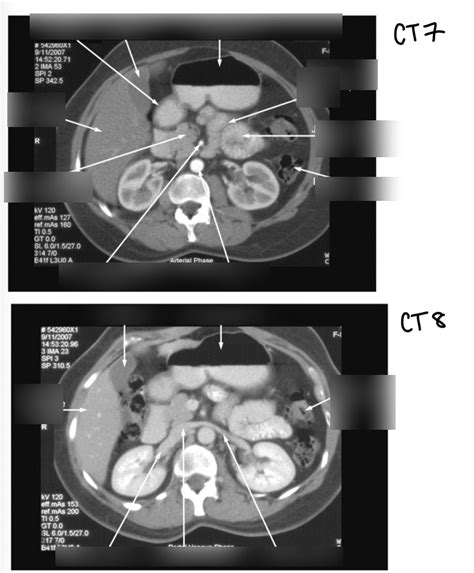 Ct7 Ct8 Diagram Quizlet