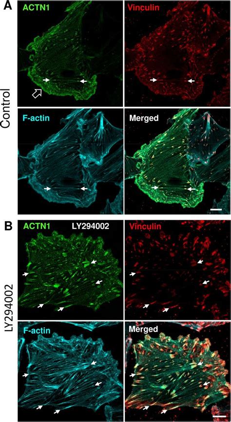 Nikon Instruments On Linkedin Microscopy Clem Livecell Imaging
