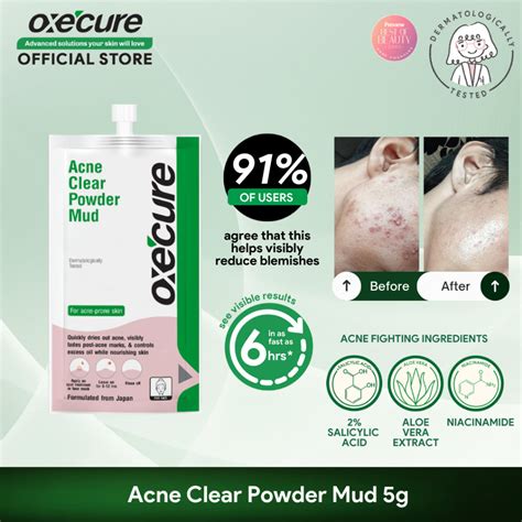 Oxecure Acne Clear Powder Mud 5g Princess Cosmetics Qatar
