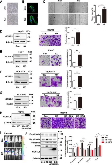 Deletion Of Gcn5l1 In Hcc Cells Promotes Cell Migration And