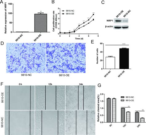 Cellular Proliferation And Migration Comparison After Nrp1