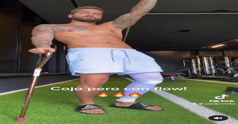 Video Maluma Sorprende Bailando Tras Cirugía En La Rodilla Cojo Pero