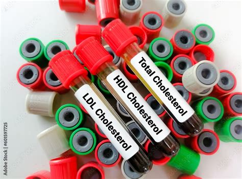 Blood Samples Isolated For Total Cholesterol Testing Hdl Cholesterol