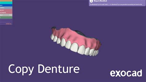 Exocad Copy Denture Tutorial Youtube