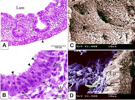 Photomicrographs Of A Digital Coloring Scanning Electron Micrograph And