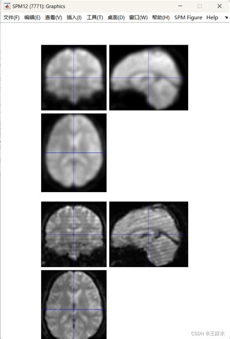 学习笔记 脑科学入门 Fmri 数据预处理g Fnirs Fmri Dti Meg等脑影像数据的处理 Csdn博客