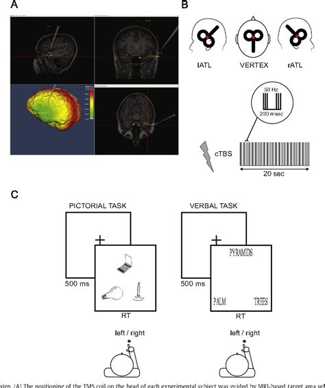 Pdf Role Of The Anterior Temporal Lobes In Semantic Representations