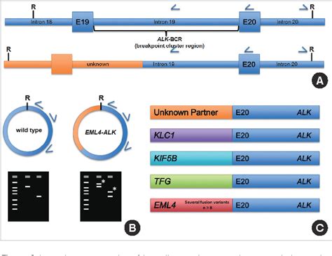 Figure 1 From Detection Of Eml4 Alk And Other Alk Fusion Genes In Lung