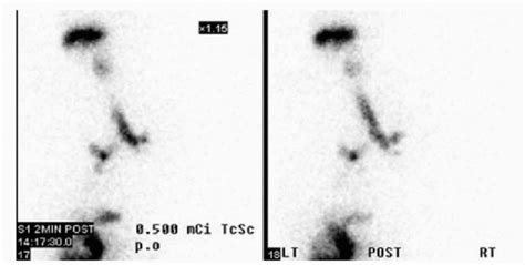 Pediatric Nuclear Medicine Radiology Key