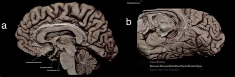 Steps 2 And 3 Of The Dissection Process A Step 2 The Cortex Of The Download Scientific