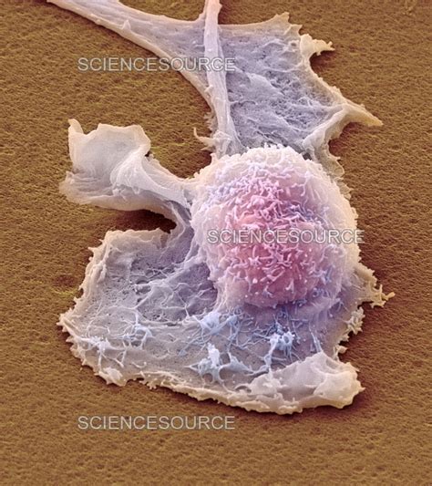 Sarcoma Cell Sem Stock Image Science Source Images