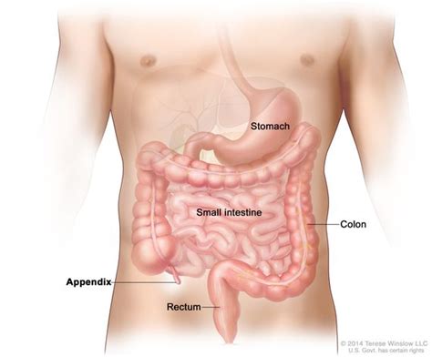 Appendix Meaning Appendicitis Ppt Download