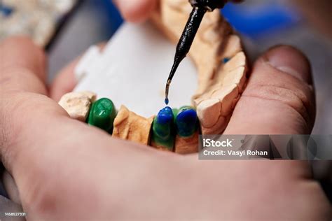 치과 기공사 치과 의사 남자는 왁스로 실험실에서 의치를 가지고 일하고 있습니다 Stem 주제에 대한 스톡 사진 및 기타 이미지