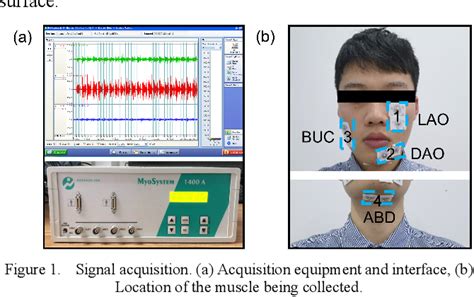 Figure 1 From A Variable Speed Silent Speech Recognition Method Based
