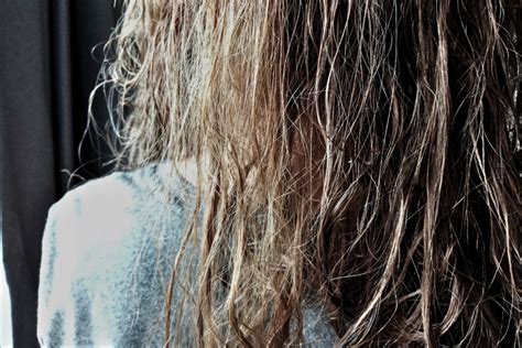O Que é Corte Químico Como Tratar E Evitar Que Aconteça