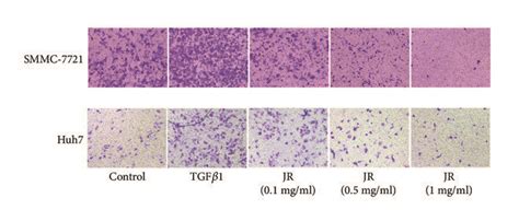 Jr Inhibits Tgfβ1 Induced Migration And Invasion Of Hcc Cells The
