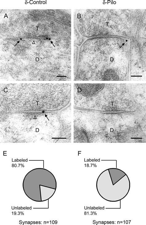 Electron Micrographs Of Subunit Immunogold Labeling In The Dentate Download Scientific Diagram