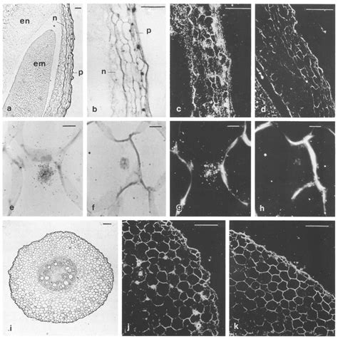 A K In Situ Localization Of Sn Mrna In Sections 8 ~tm From