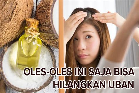 Biar Tau Aja Nih Ini Cara Hilangkan Uban Gak Akan Datang Lagi Mau