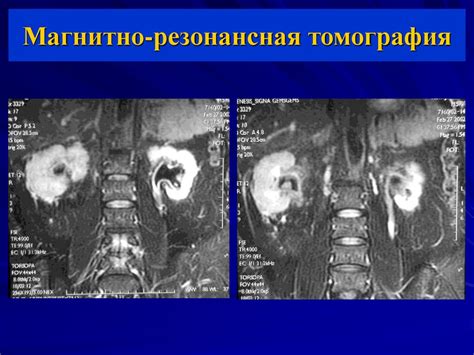 Мочекаменная болезнь - презентация онлайн