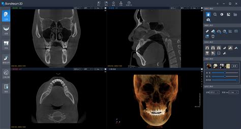 口腔cbct 博爵cbct 博恩集团