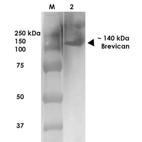 Brevican Monoclonal Antibody N294a 6 Apc Ma5 45596