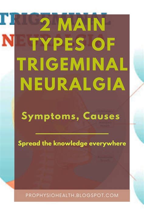 Important Main Types Of Trigeminal Neuralgia Trigeminal Neuralgia