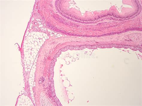 Histology Of Trachea Human Tissue Stock Image Image Of Show Biology