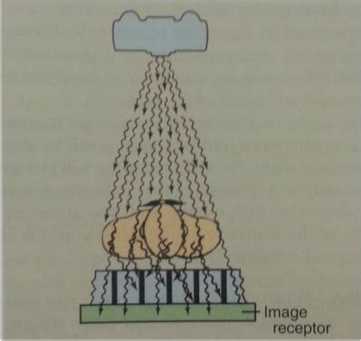 Grid Alignment Quality Control In Radiography