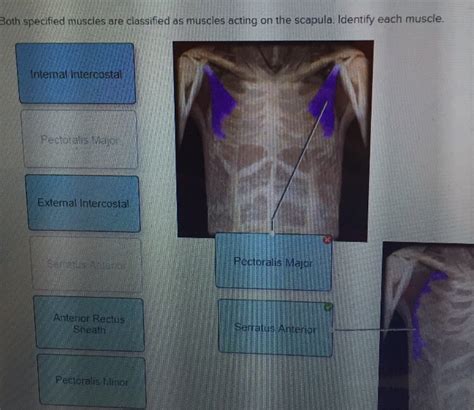 Solved Both Specified Muscles Are Classified As Muscles