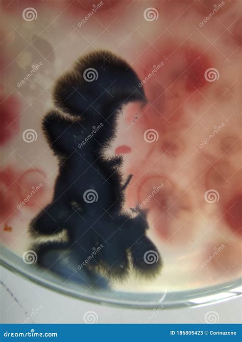 Aureobasidium Pullulans And Fusarium Stock Image Image Of Medium Biological 186805423