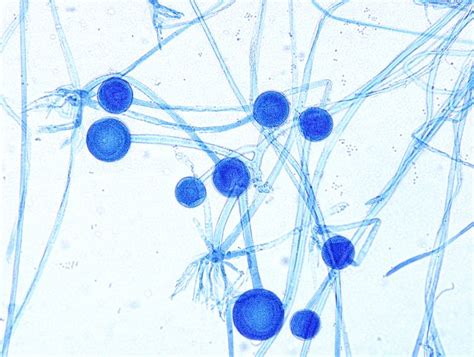 Rhizopus Alchetron The Free Social Encyclopedia