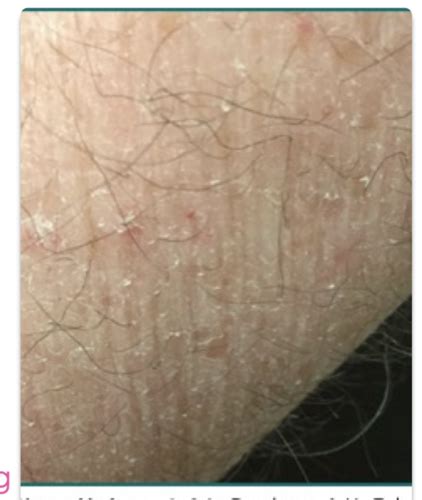 Aging Of Integumentary System Dr Frederich Flashcards Quizlet