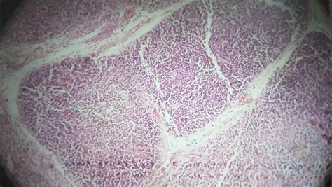 Lobule With Cortex And Medulla Of 22 Weeks Fetus H And E 40x Download Scientific Diagram