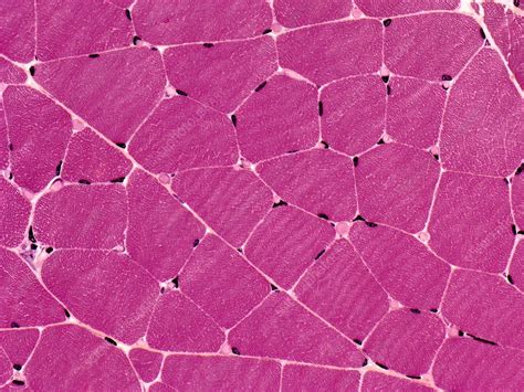 Solved Skeletal Muscle Tissue In Cross Section 50 Off