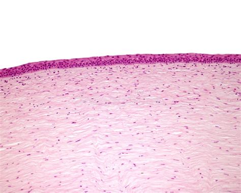 Stratified Squamous Nonkeratinized