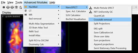 Crosstalk Removal Vivoquant User Manual