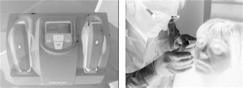 5 A Tearlab Osmometer Based On Electrical Conductivity Technique