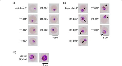 Morphological Analysis Of Anti Malarial Activity Of Basic Blue 3 And Download Scientific