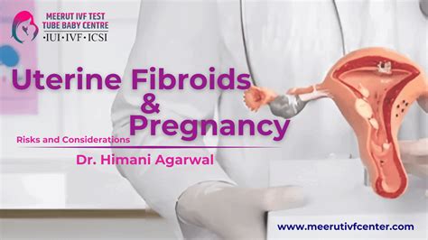 Uterine Fibroids And Pregnancy Risks And Considerations Meerut Ivf