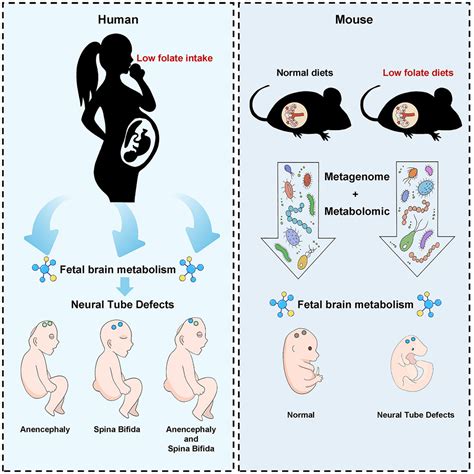 Anencephaly Diagram