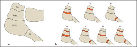 Shoulder Joint Radiology Key