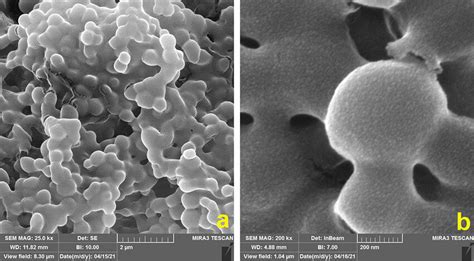 Representative Fesem Field Emission Scanning Electron Microscopy Download Scientific Diagram