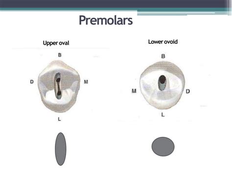 Anatomy Of Pulp Canal And Its Access Opening Ppt