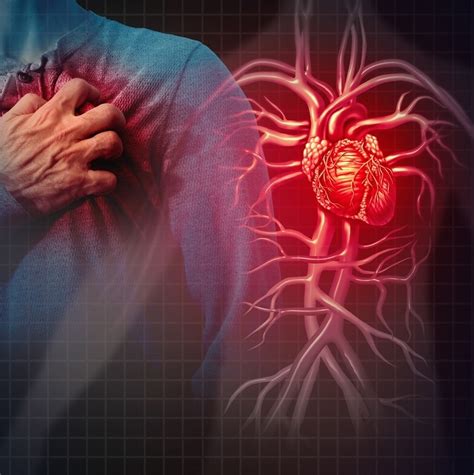 Infarto o que é e como diagnosticar Ana Ortolan