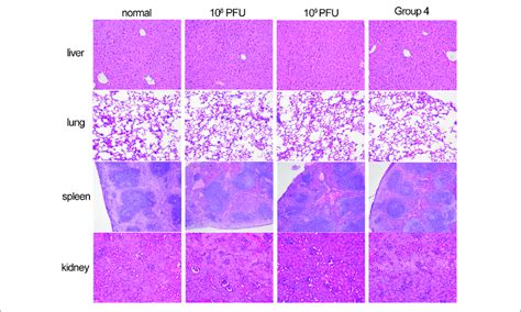 Histopathology Of Spleen Lung Kidney And Liver Tissues From Normal