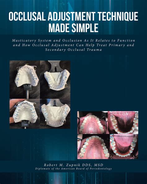 Occlusal Adjustment Technique Made Simple Readerhouse